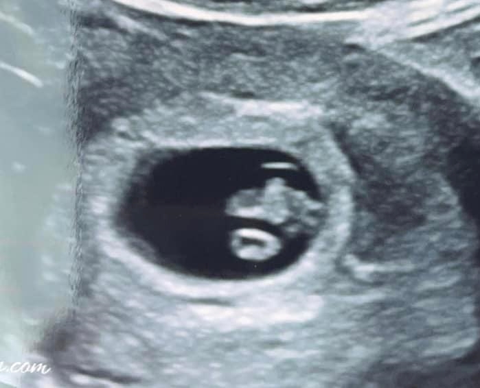 The Early Stages Of Pregnancy 0 16 Weeks Your Baby Scan